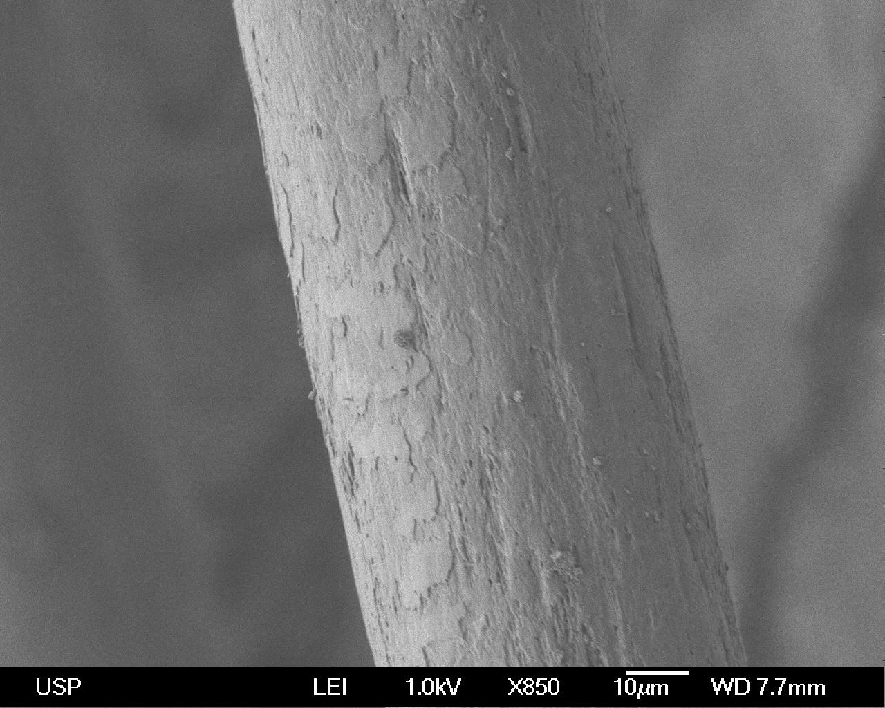 Damaged Human Hair Under Microscope